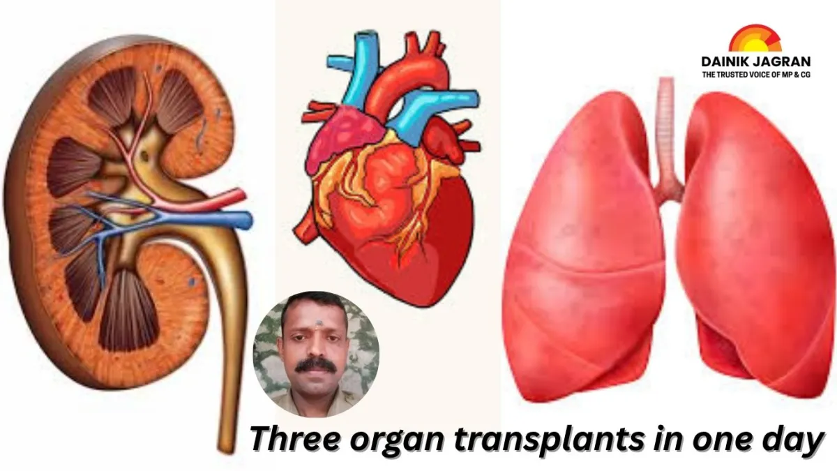 1st ever lung transplant in the country - Dainik Jagran English